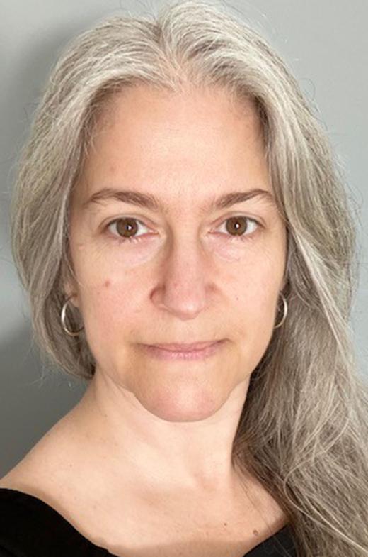 Elsa Fuster-Mears | Face Model and Casting Agency